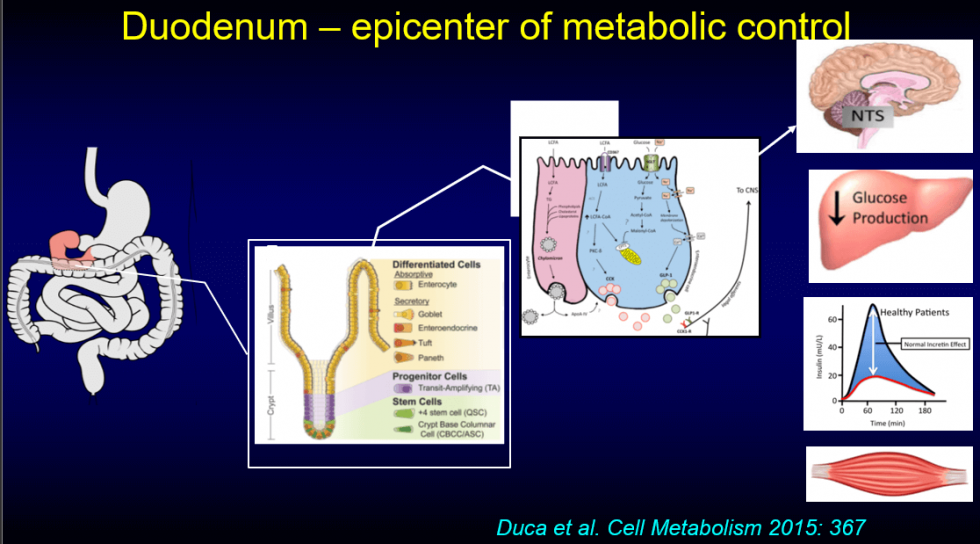Endo Bariatric Surgery On-board to Treat Obese Diabetic - CME INDIA