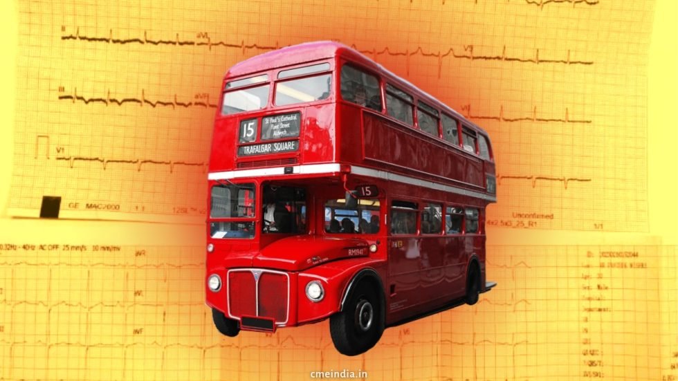 How The Bus Was Missed After Chest Pain in Gym & ECG Found Normal ...