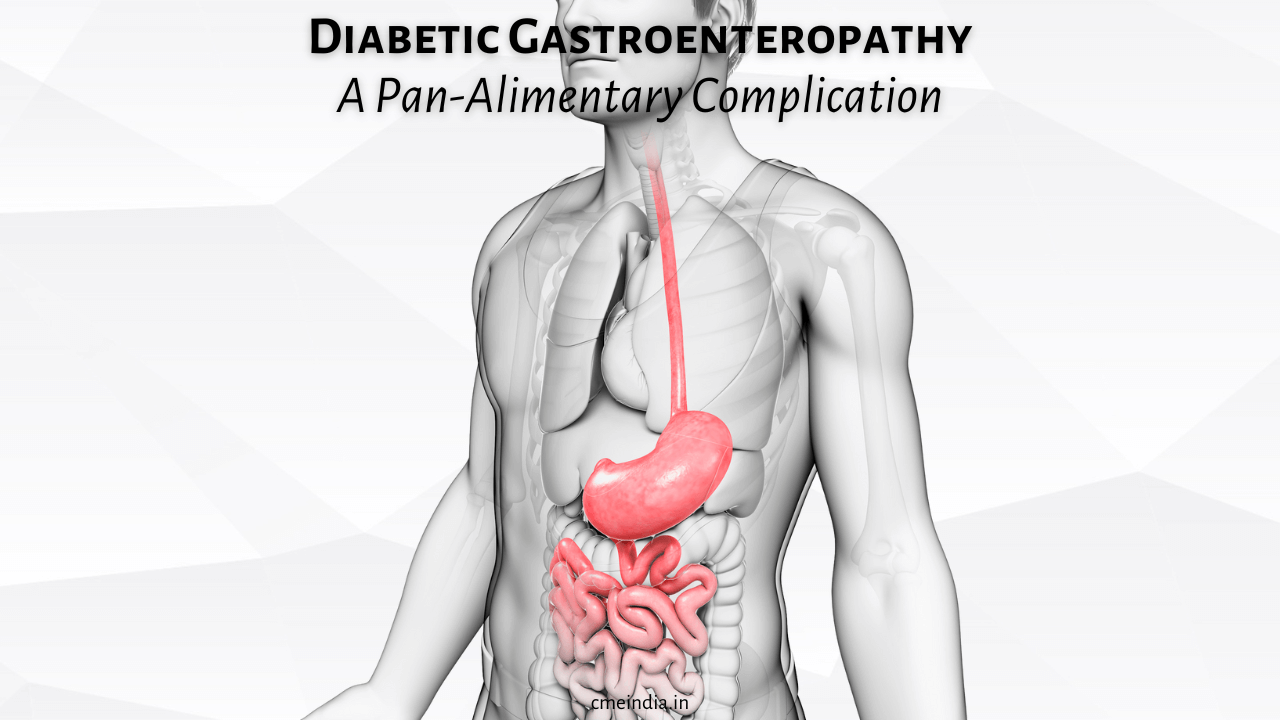Diabetic Gastroenteropathy: A Pan-Alimentary Complication - CME INDIA